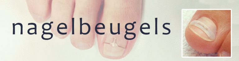 Nagelbeugeltechnieken - VOETPUNT TWENTE